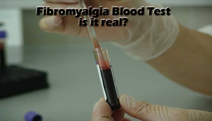 Fibromyalgia Blood Test - Is it Real? - Counting My Spoons