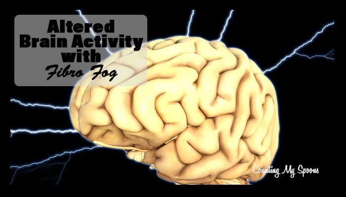 Altered brain activity related to fibro fog - Counting My Spoons