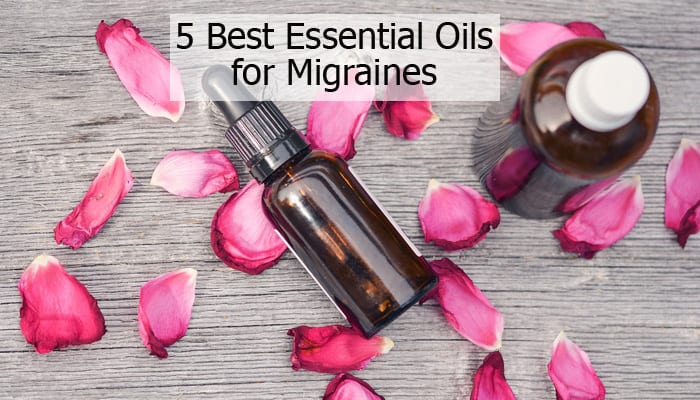 5 Best Essential Oils for Migraines - Counting My Spoons